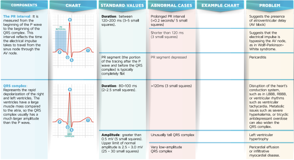 How to read your ECG – BUZUD Singapore