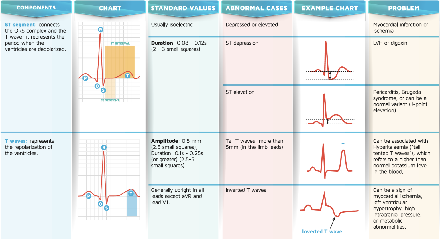 How to read your ECG – BUZUD Singapore