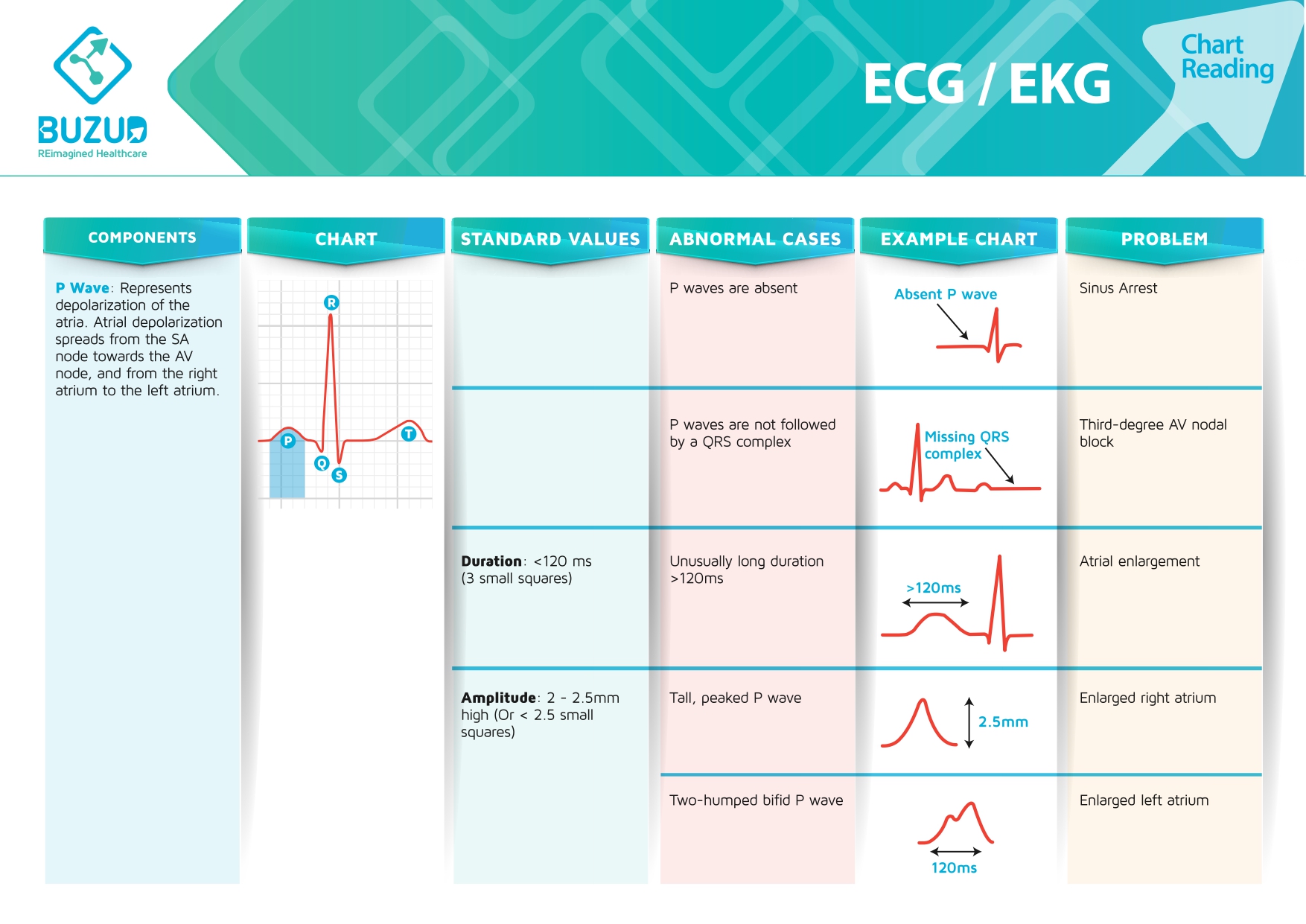 How To Read Your ECG Roffe International
