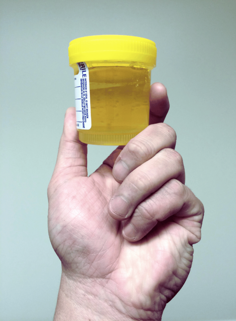 Understanding what your urine is telling you about your health – BUZUD ...