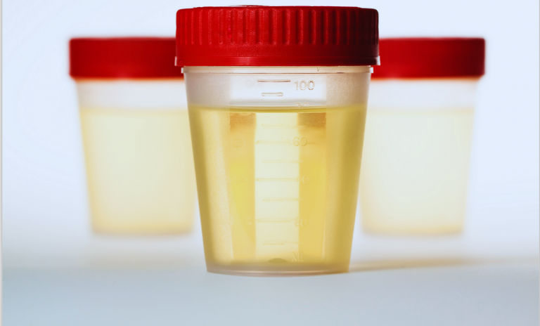 Understanding what your urine is telling you about your health – BUZUD ...